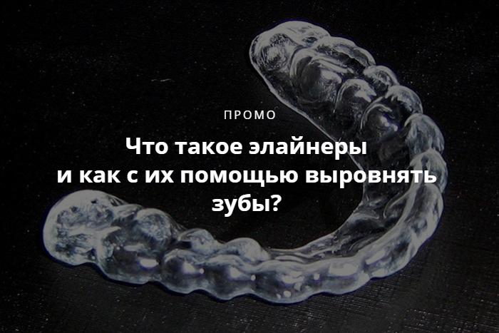 Как выровнять зубы без брекетов?. «Бумага»