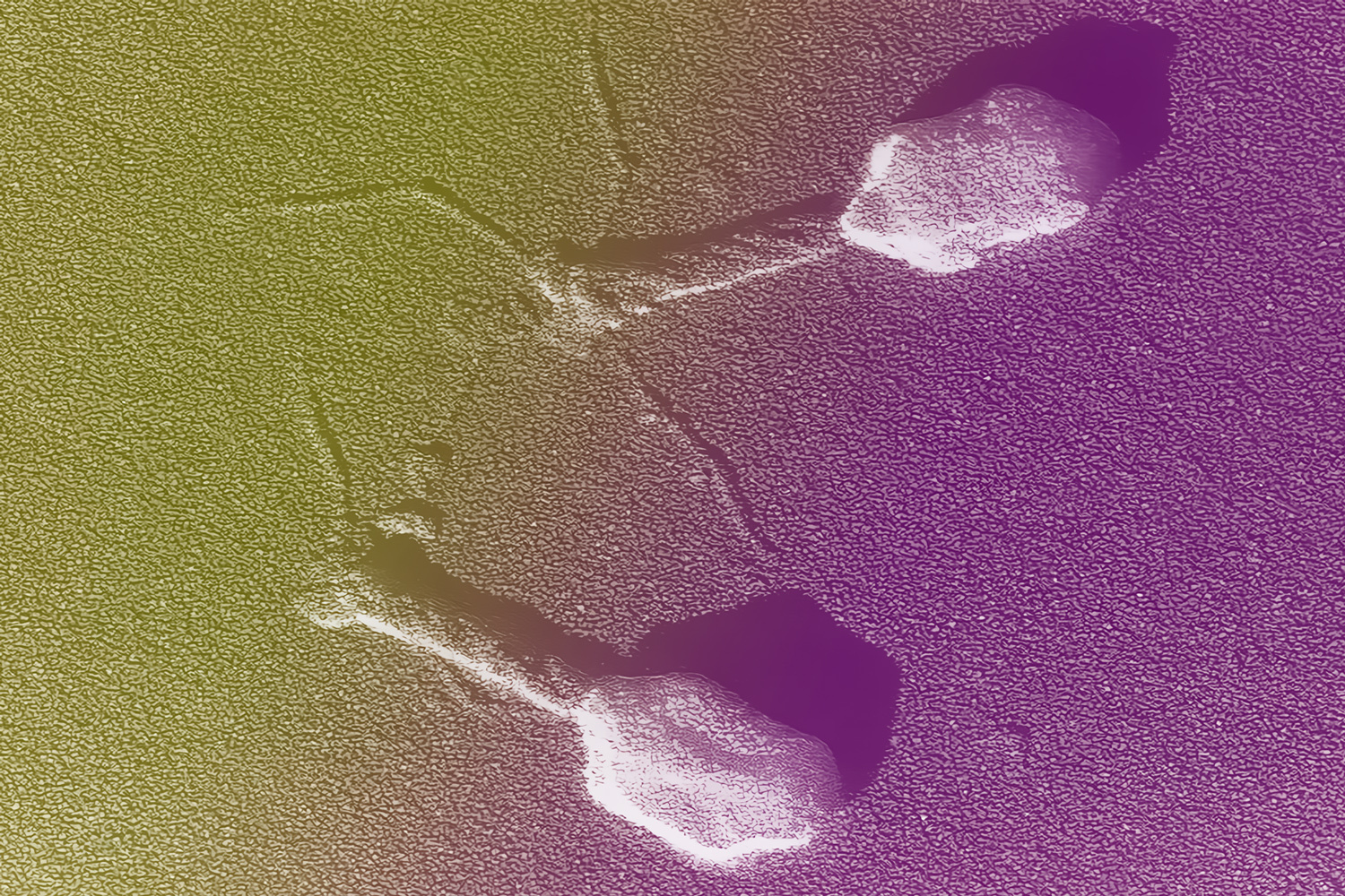 Более века назад ученые из Грузии и Франции открыли метод терапии ...